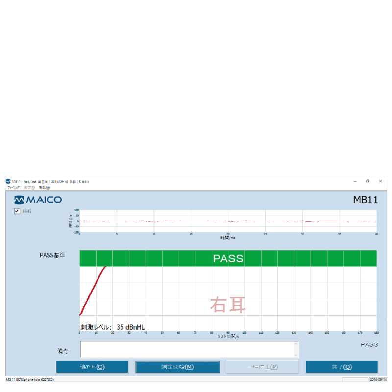 自動ABR | ダイアテックカンパニー