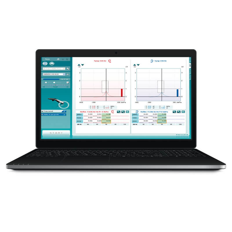 Interacoustics Titan Middle Ear Analyzer